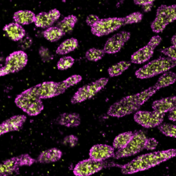DNA-PAINT Kit Archives - Massive Photonics