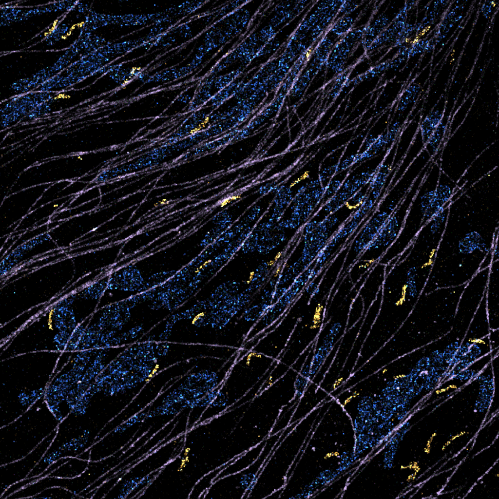 MASSIVE-AB 3-PLEX - Massive Photonics